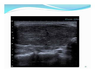 08Thyroid.pdf ultrasound of the thyroid. | PPT