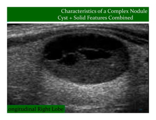 08Thyroid.pdf ultrasound of the thyroid. | PDF