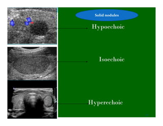 08Thyroid.pdf ultrasound of the thyroid. | PPT