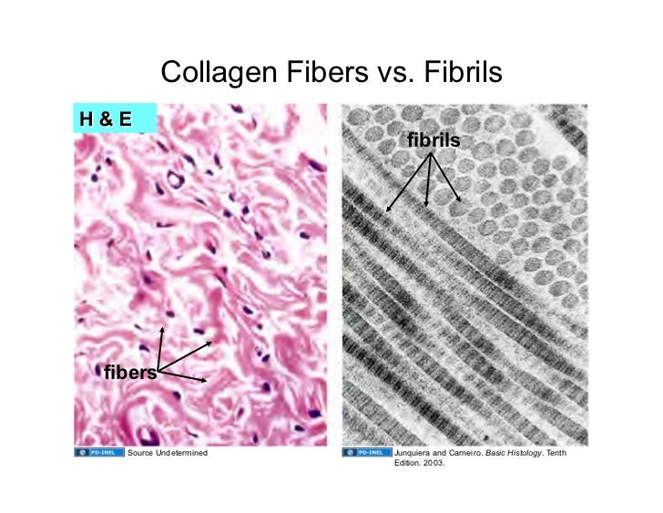 09.10.08: Connective Tissue