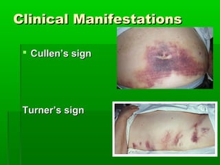 Interventions for clients with liver, gallbladder and pancreas ...