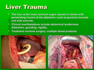 Interventions for clients with liver, gallbladder and pancreas ...