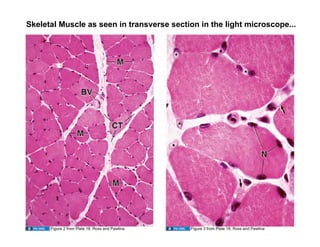 Skeletal Muscle Cross Section Labeled
