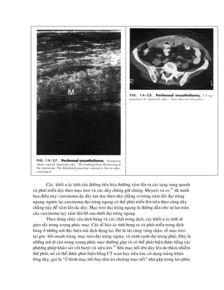09.siêu âm xoang phúc mạc cơ hoành | PDF