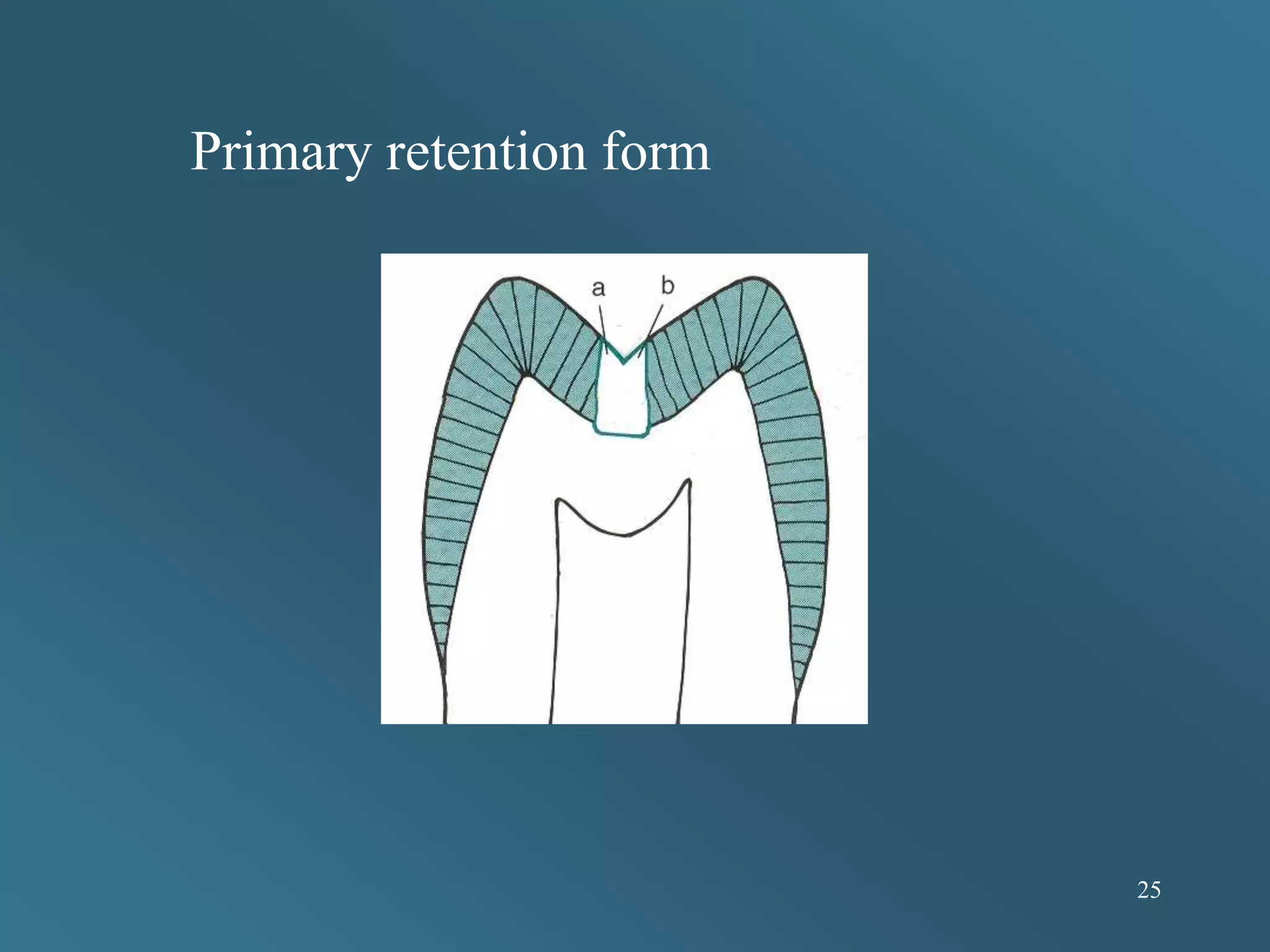 09.amalgam cavity designs | PPTX