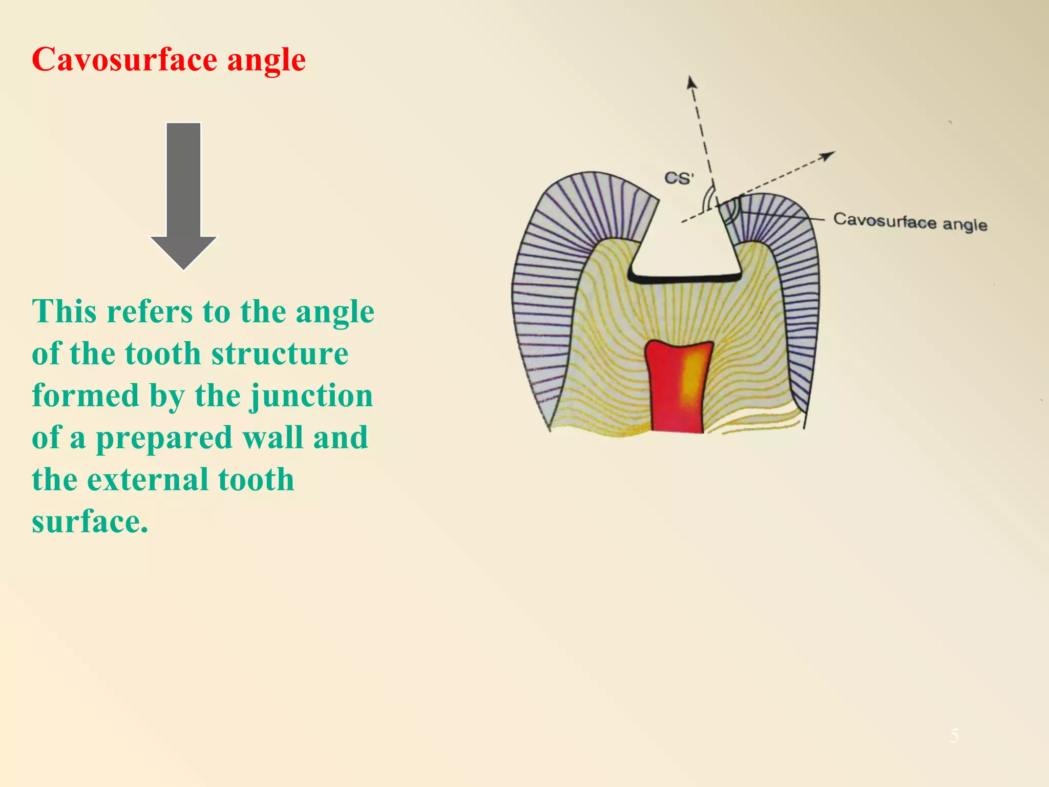 09.amalgam cavity designs | PPTX