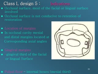 09.amalgam cavity designs | PPTX