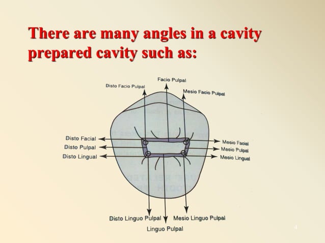 09.amalgam cavity designs | PPTX | Dental Health | Diseases and Conditions