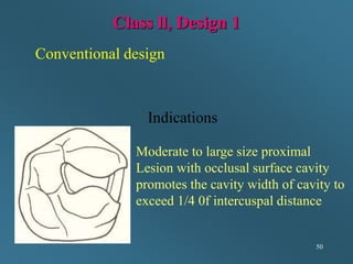 09.amalgam cavity designs | PPTX