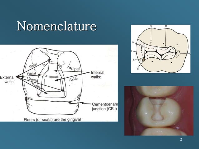 09.amalgam cavity designs