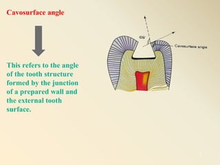 09.amalgam cavity designs | PPT