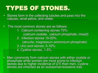 09. RENAL CALCULI.ppt