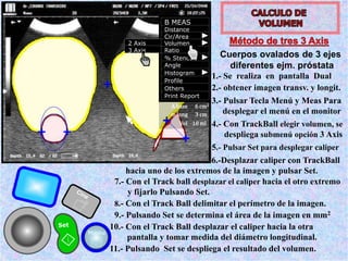 09.INSTRUMENTACION DEL ECOGRAFO DP 2020.pptx
