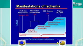 09. Ischaemia assessments - What, when and which one.pdf