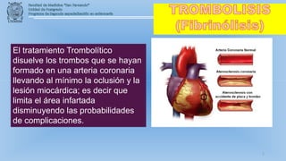 trombolisis - fibrinolisis - consideraciones | PDF