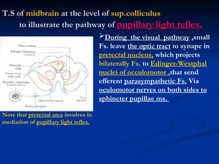 Cranial Nerves and Cranial nerve nuclei.ppt