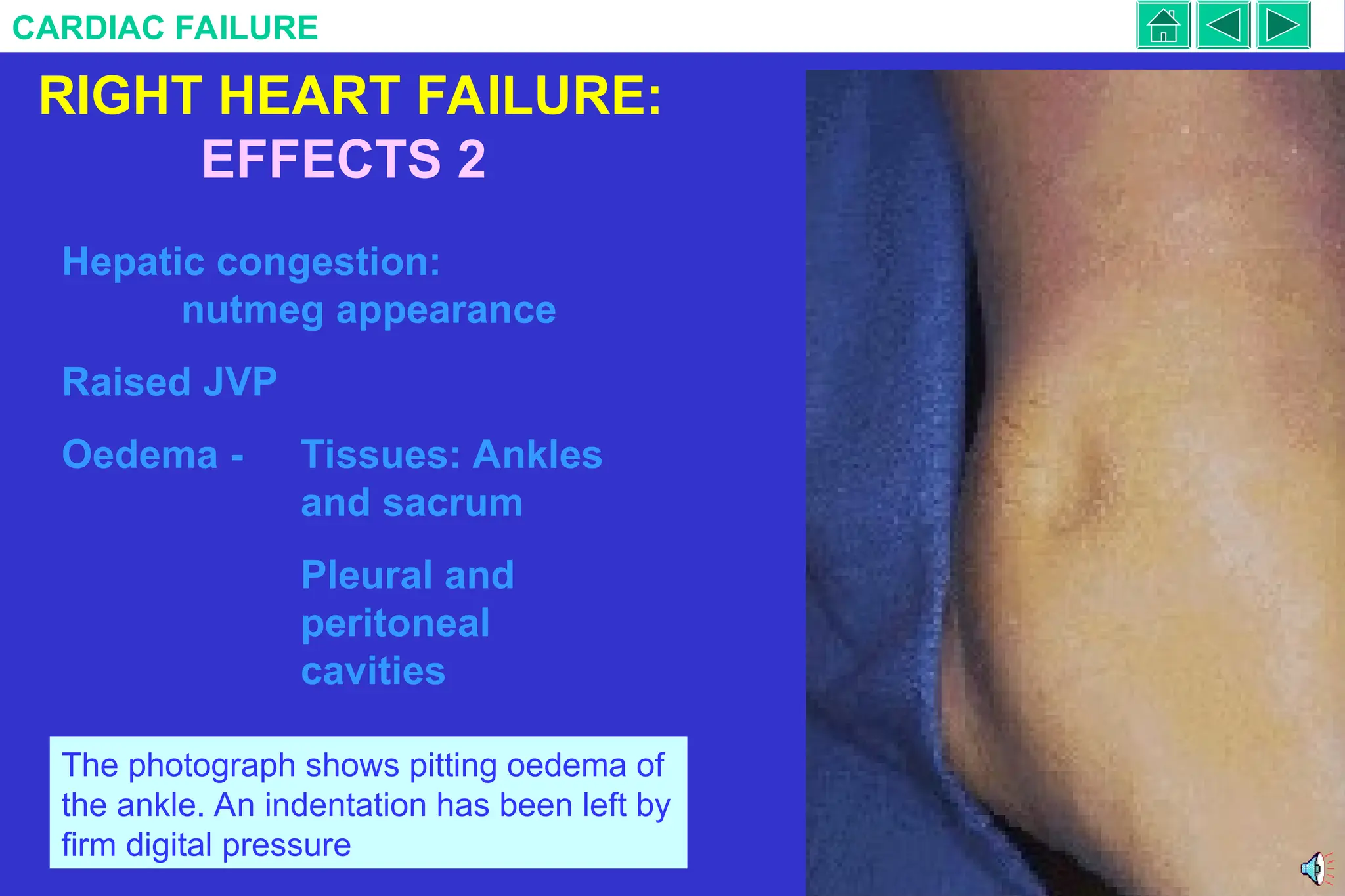 09-CARDIAC-FAILURE.presentation slidesss | PPT