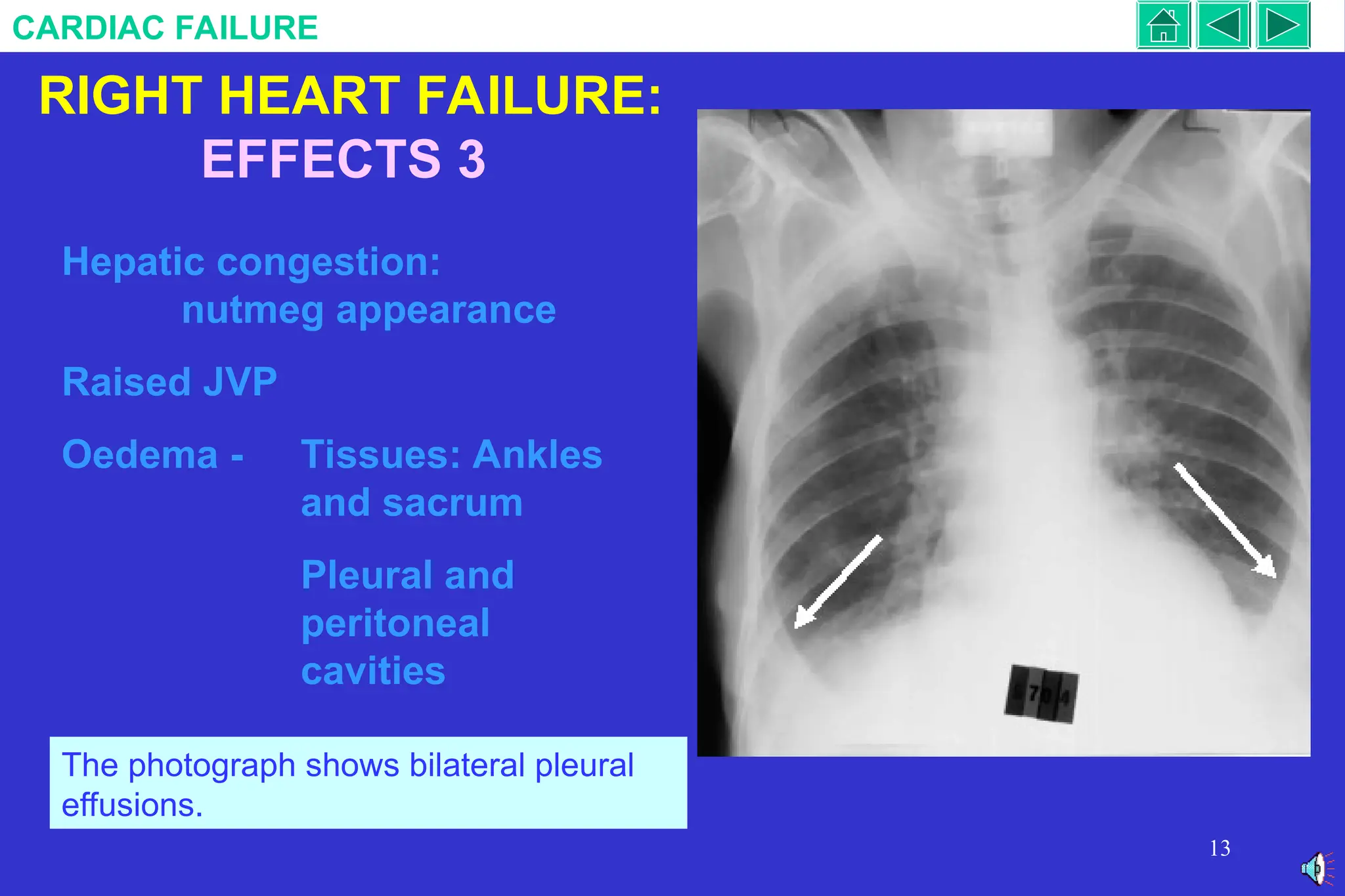 09-CARDIAC-FAILURE.presentation slidesss | PPT