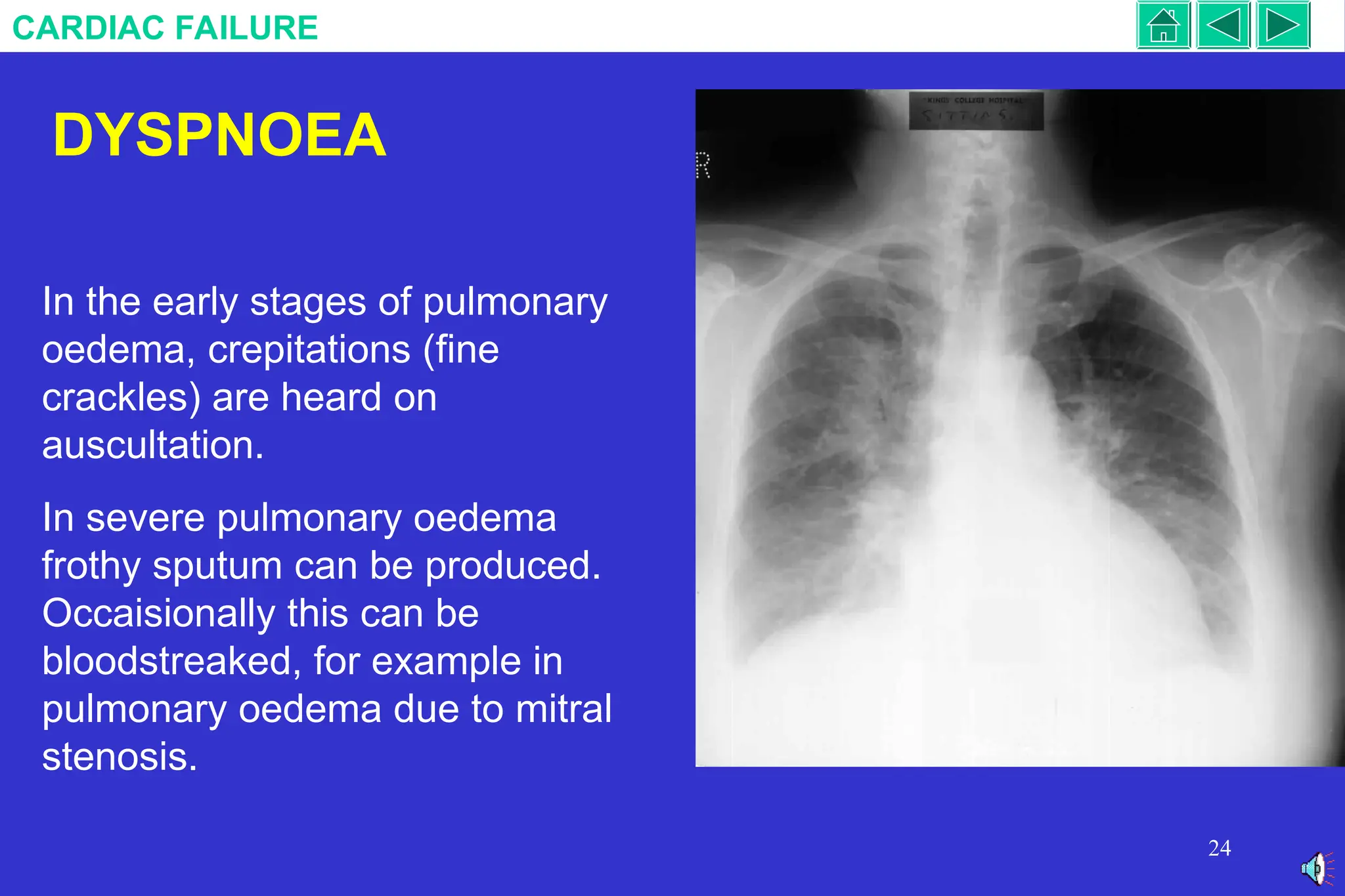 09-CARDIAC-FAILURE.presentation slidesss | PPT