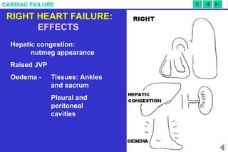 09-CARDIAC-FAILURE.presentation slidesss | PPT