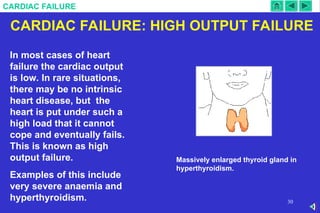 09-CARDIAC-FAILURE.presentation slidesss | PPT
