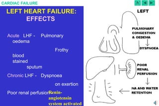 09-CARDIAC-FAILURE.presentation slidesss | PPT