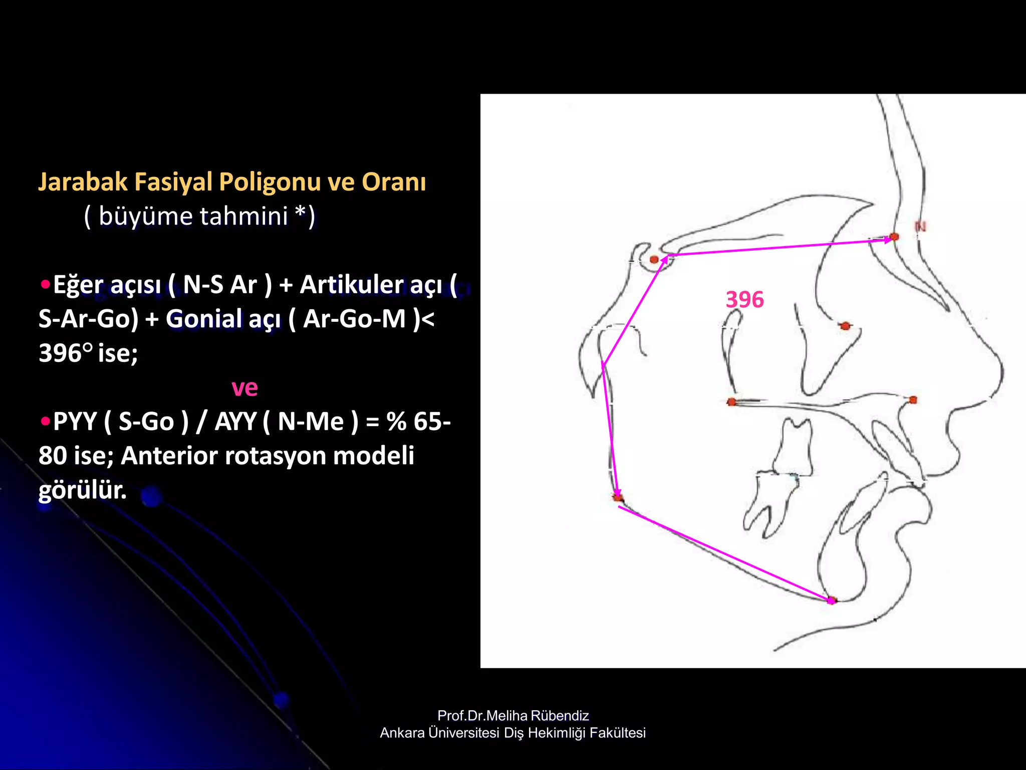 Derin kapanış vakalarının etyolojisi ve morfolojisi.pptx