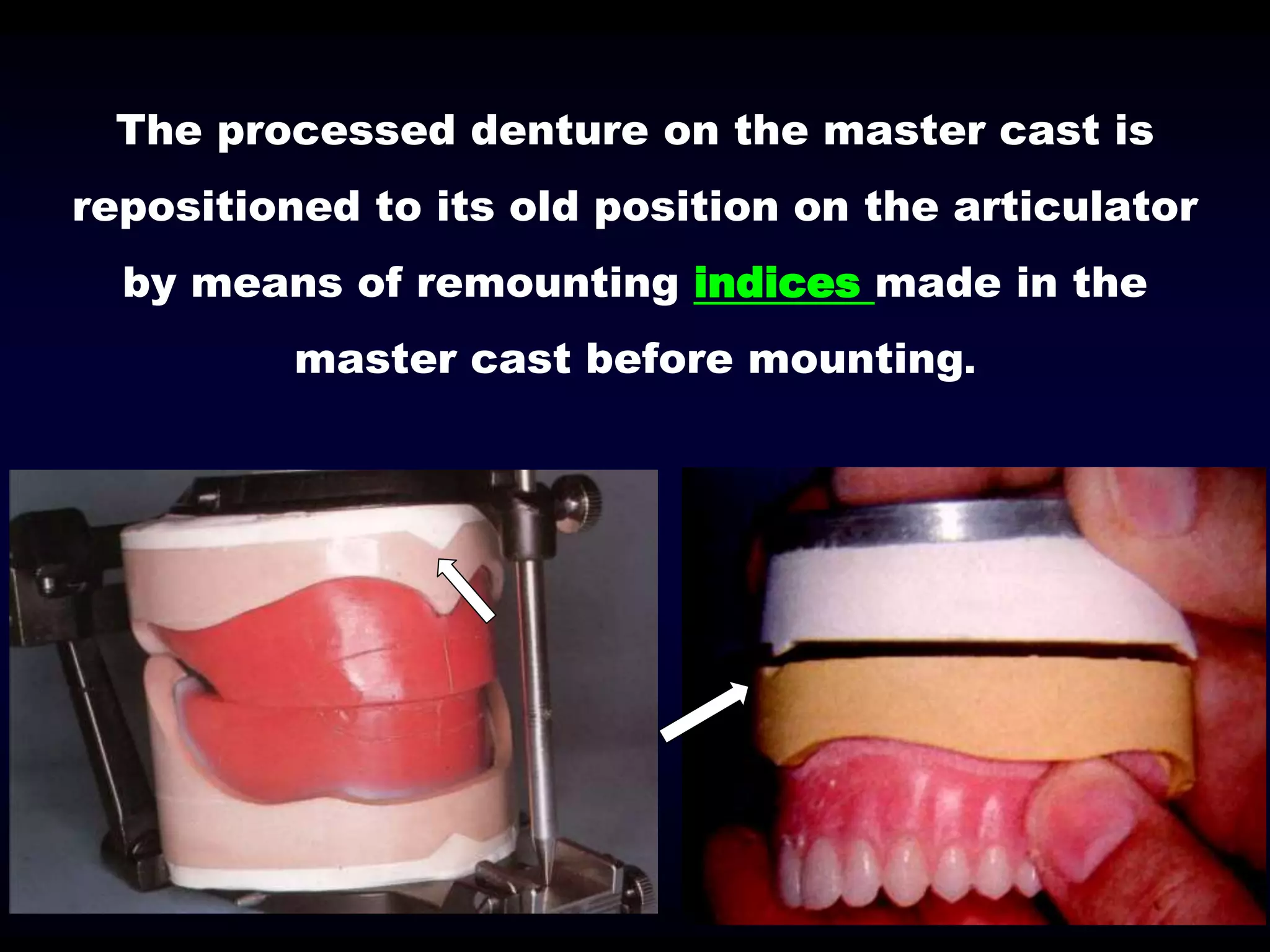 09- Occlusion in prosthodontics- occlusal correction.ppt