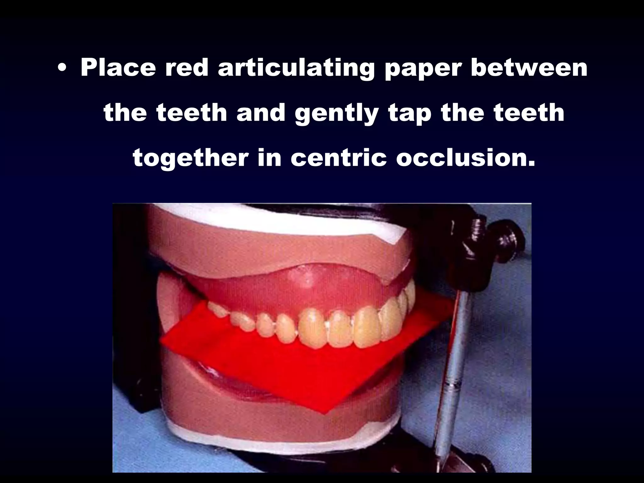 09- Occlusion in prosthodontics- occlusal correction.ppt