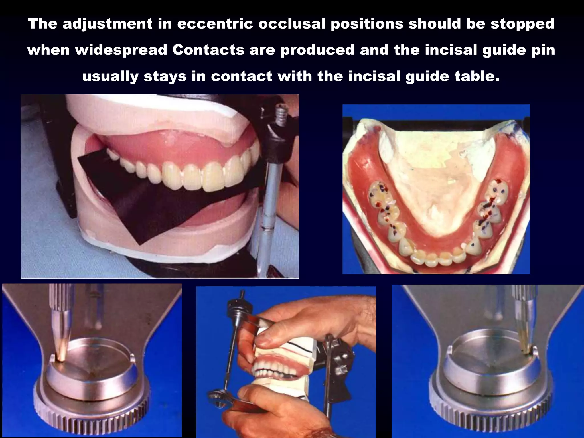 09- Occlusion in prosthodontics- occlusal correction.ppt
