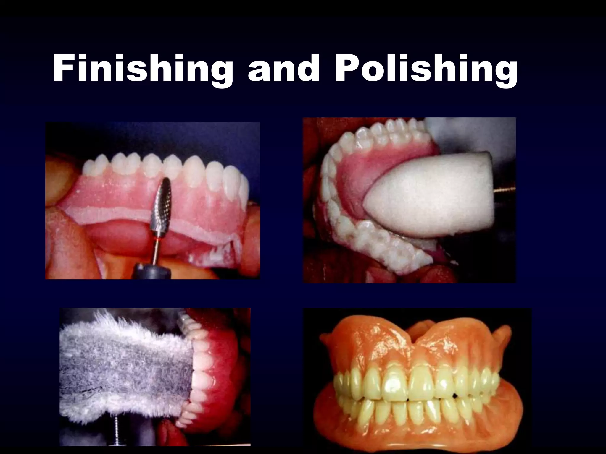 09- Occlusion in prosthodontics- occlusal correction.ppt