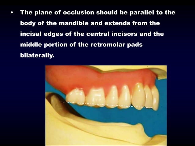 09- Occlusion in prosthodontics- occlusal correction.ppt | Dental ...