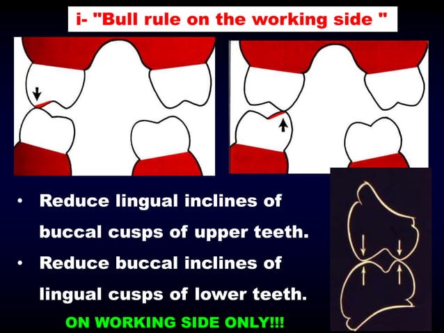 09- Occlusion in prosthodontics- occlusal correction.ppt