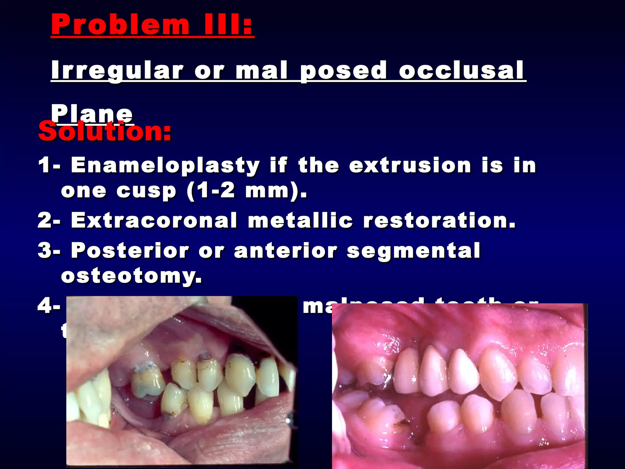 8- Occlusal Relationships for Removable Partial Dentures | PPT