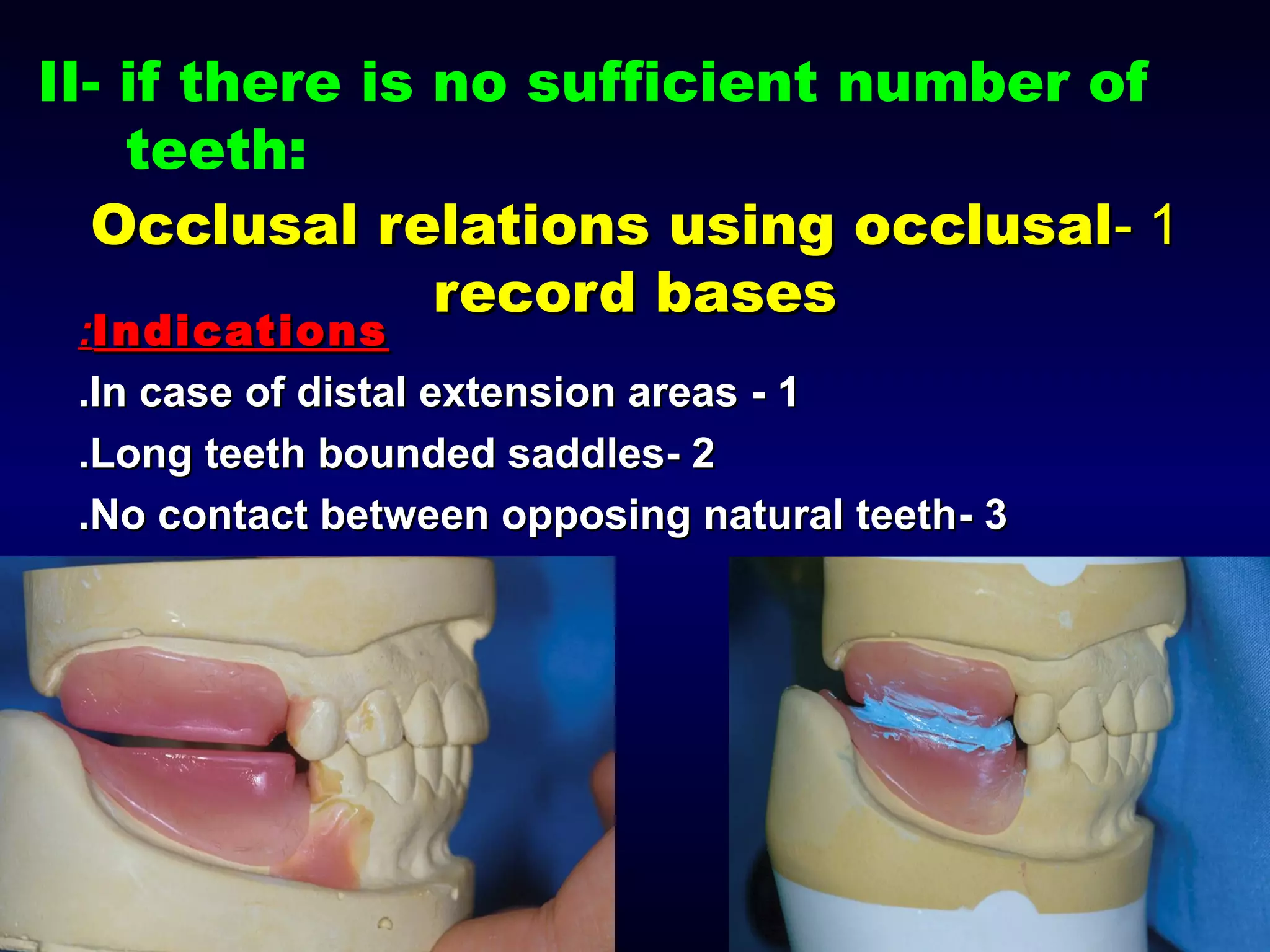 8- Occlusal Relationships for Removable Partial Dentures | PPT