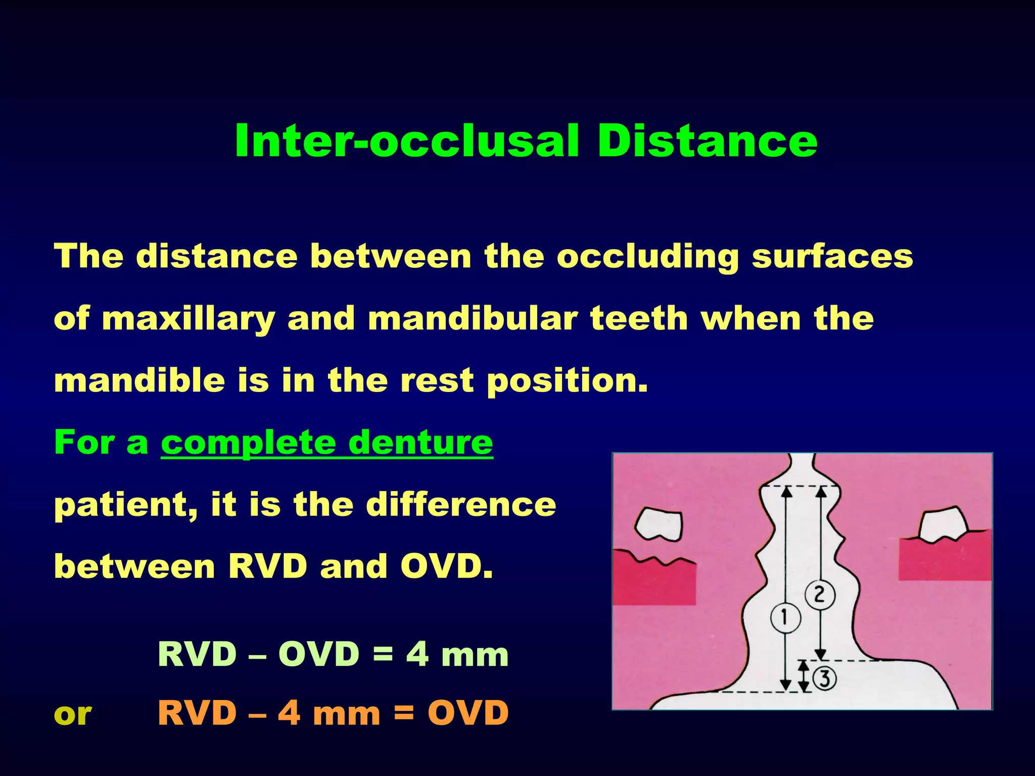 8- Occlusal Relationships for Removable Partial Dentures | PPT