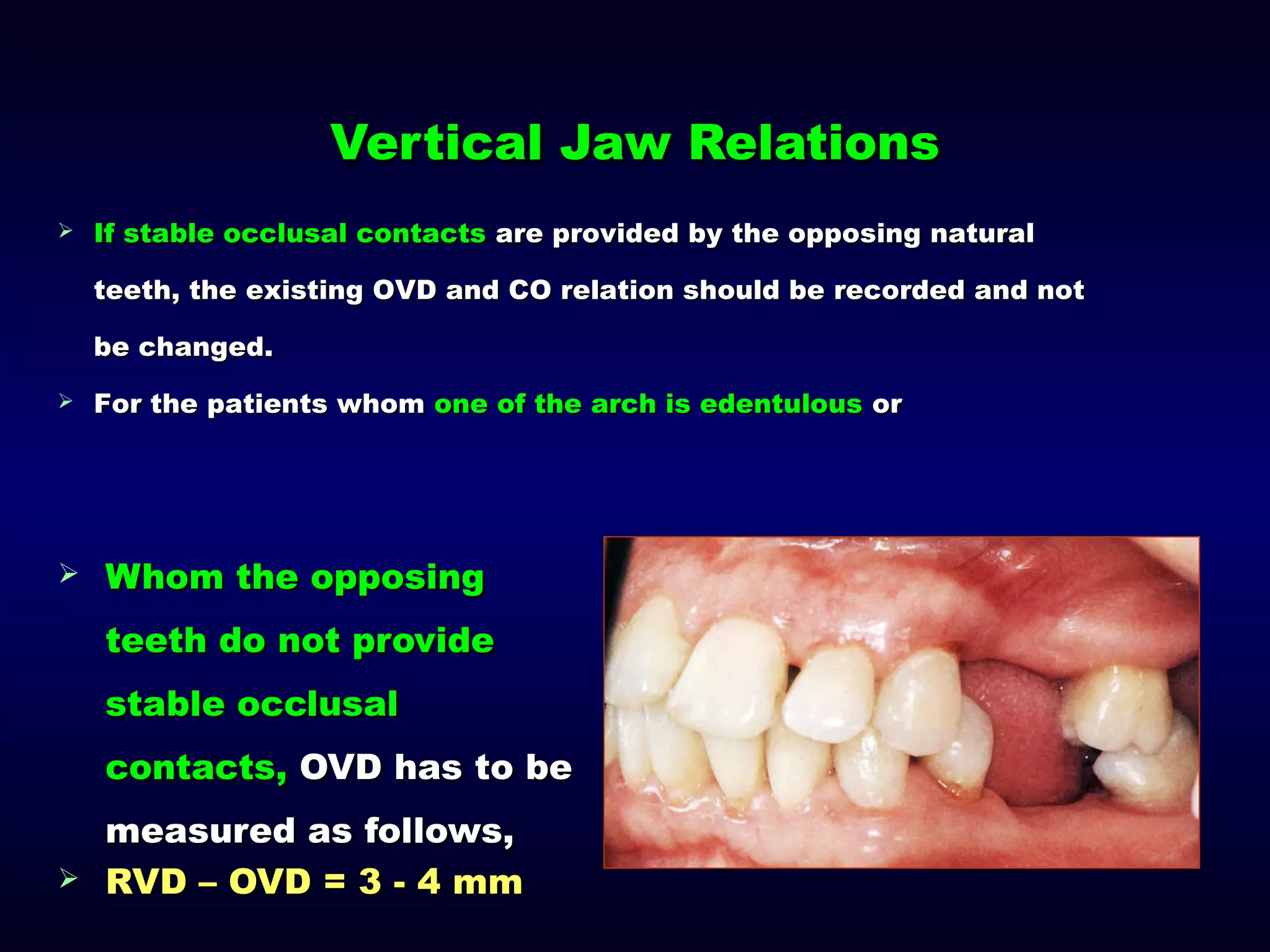 8- Occlusal Relationships for Removable Partial Dentures | PPT