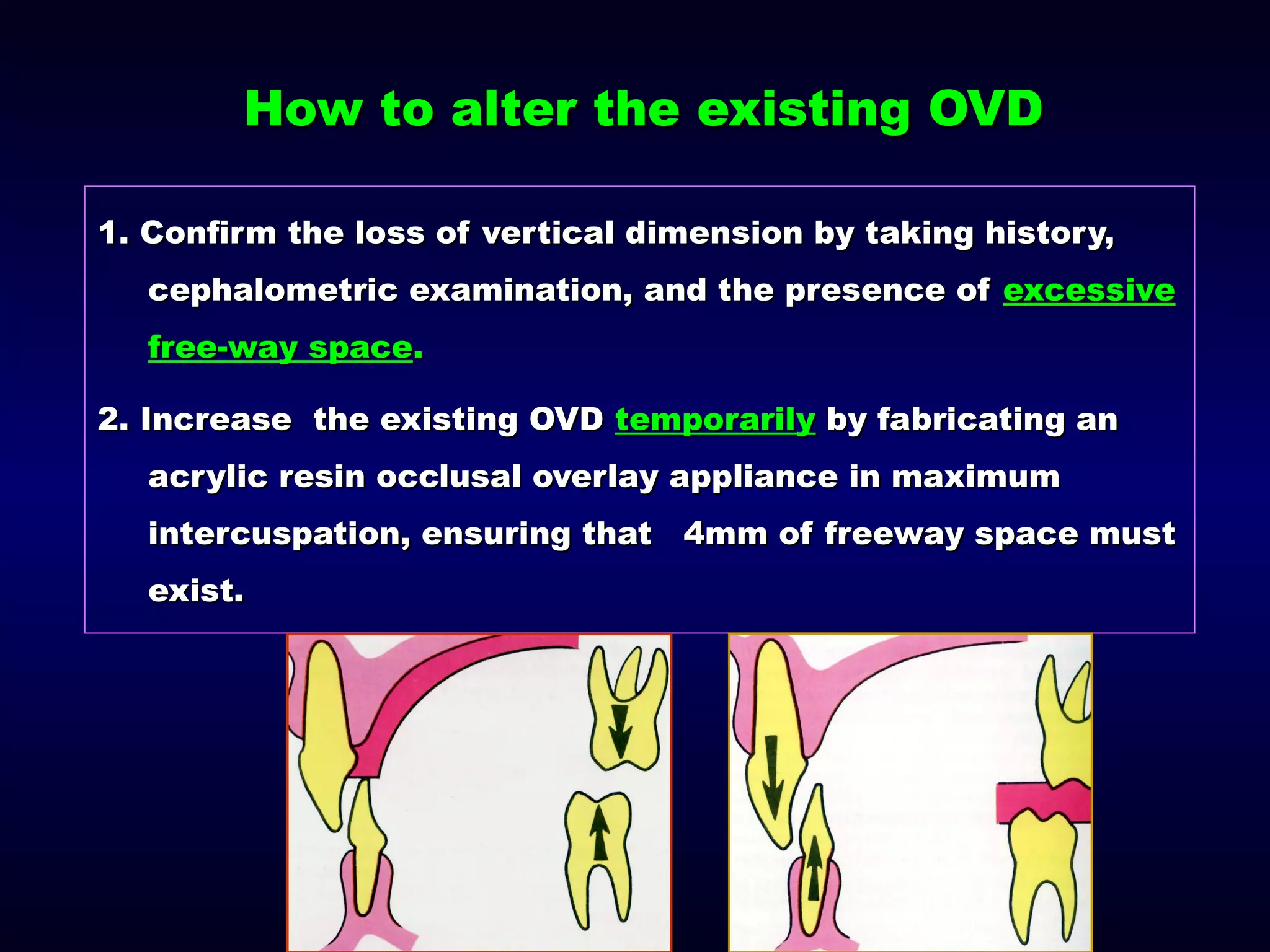 8- Occlusal Relationships for Removable Partial Dentures | PPT