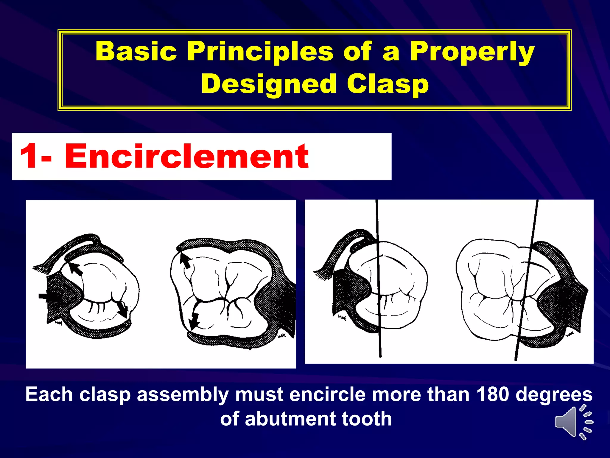Direct Retainers of RPDs | PPT
