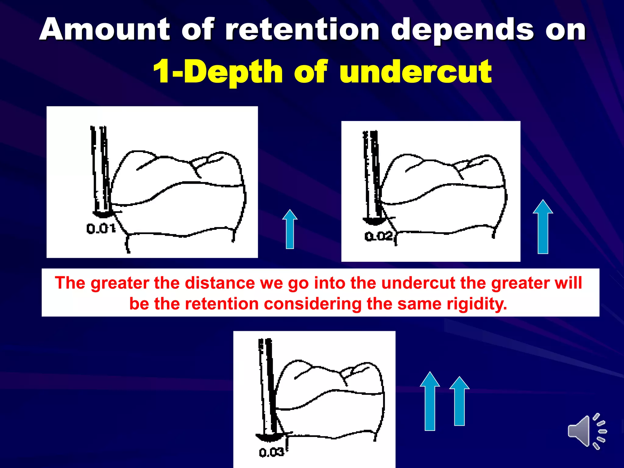 Direct Retainers of RPDs | PPT
