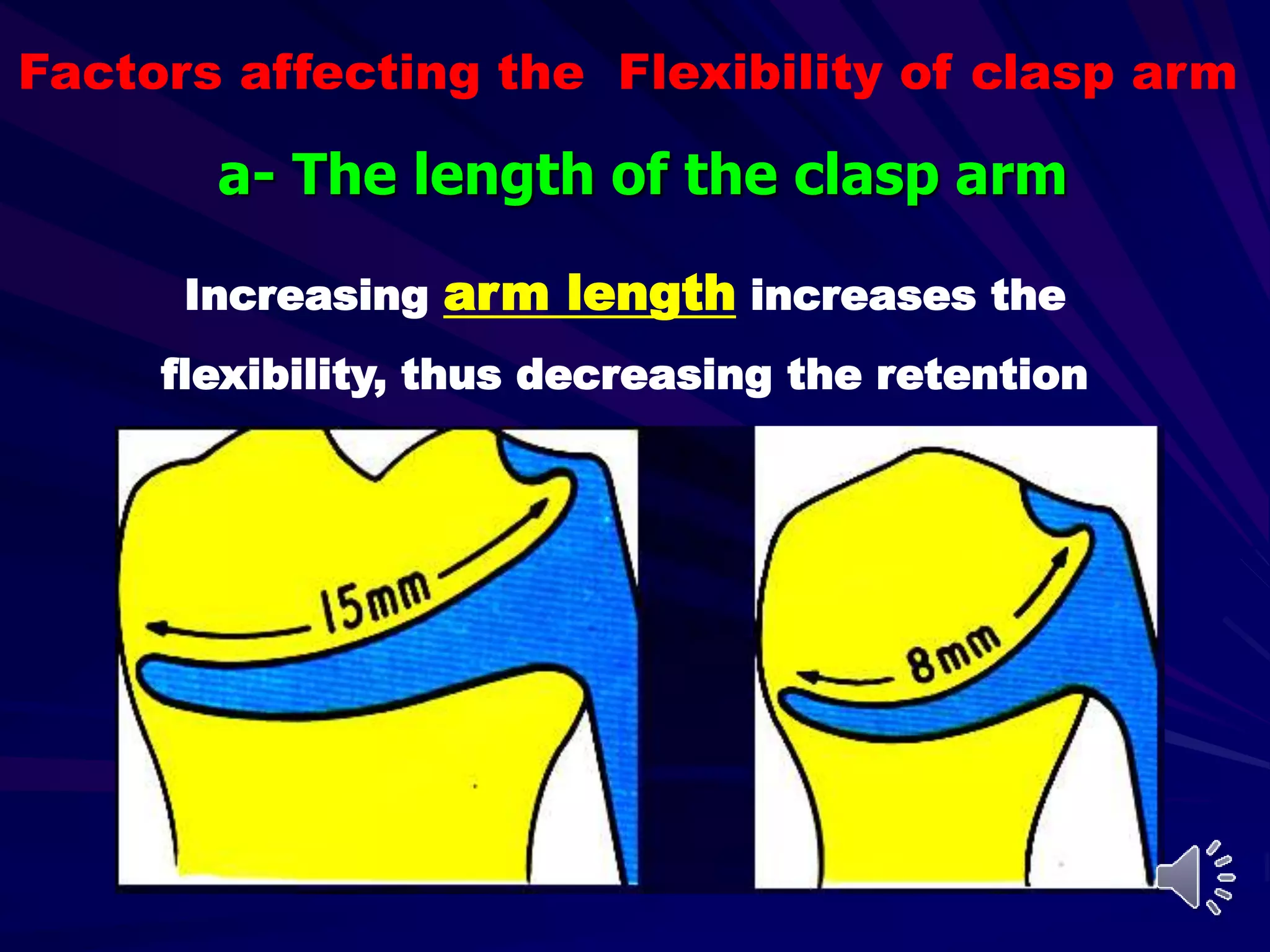 Direct Retainers of RPDs | PPT