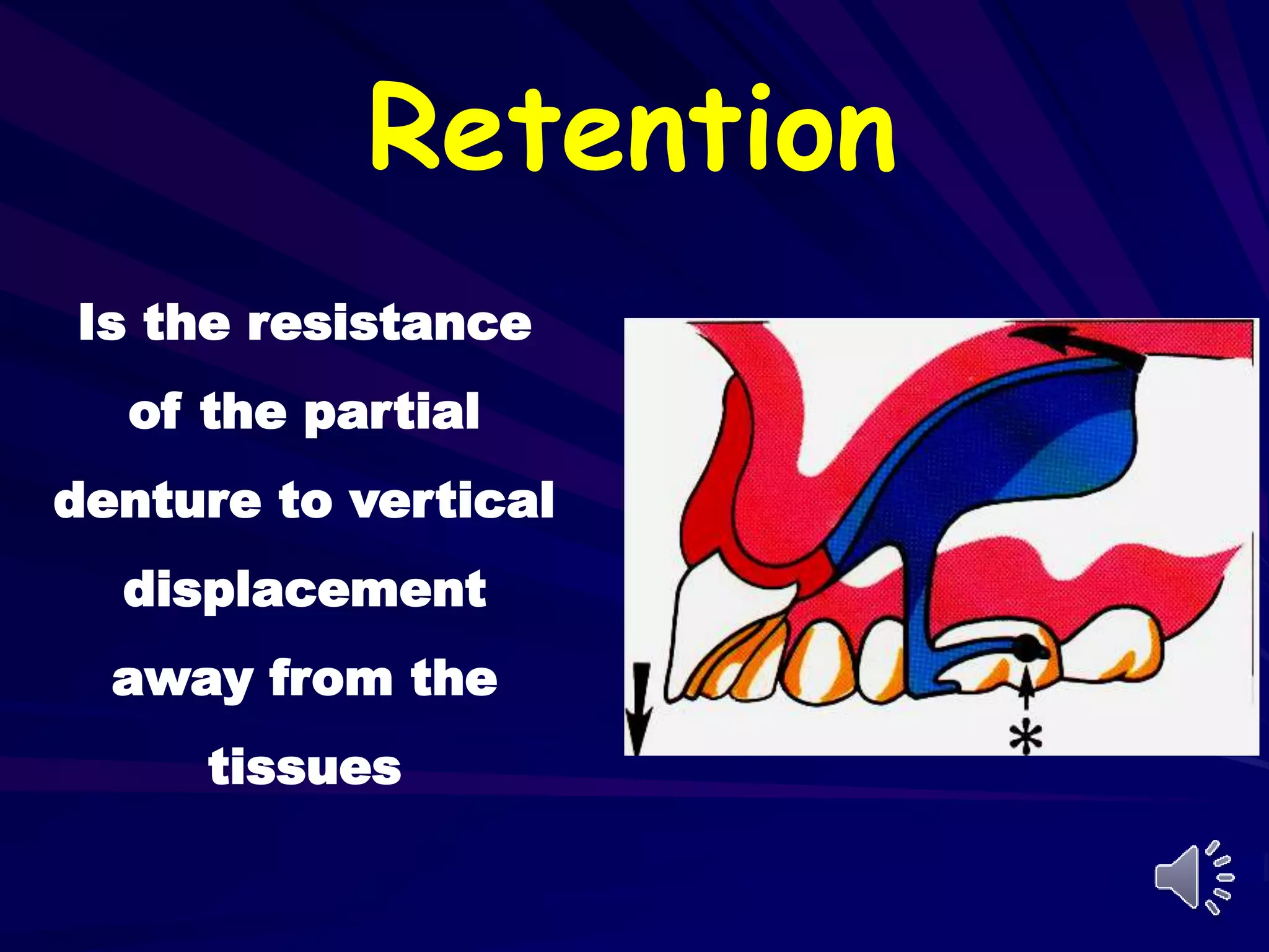Direct Retainers of RPDs | PPT