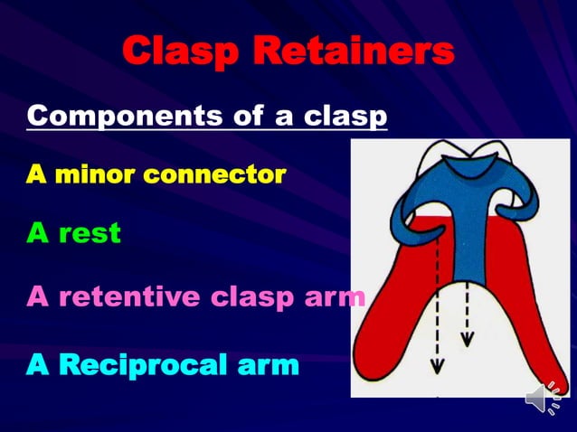 Direct Retainers of RPDs | PPT