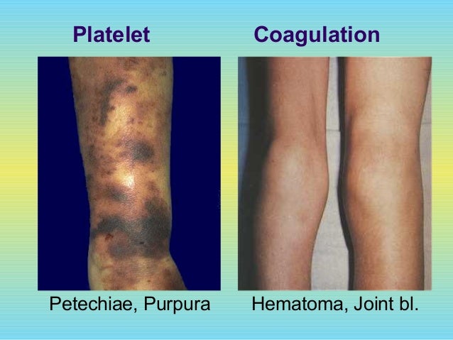 Types Of Bleeding