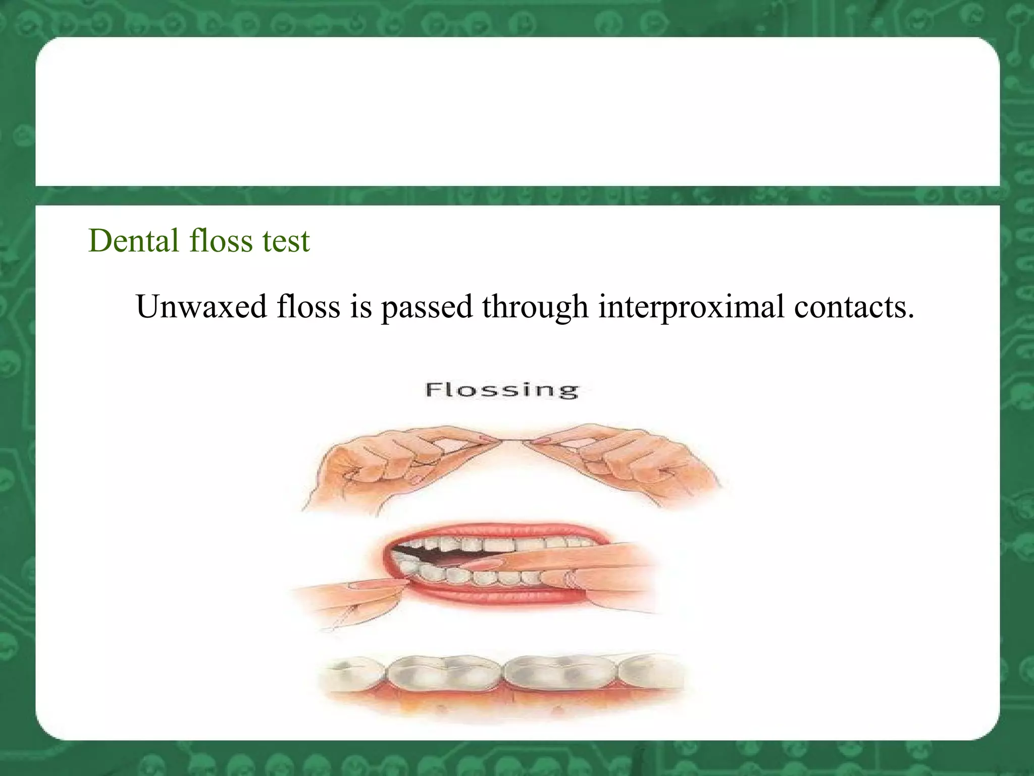 halitosis.ppt