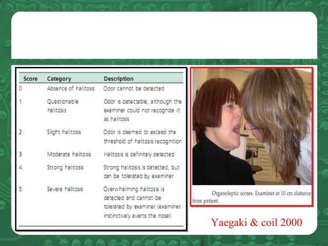 halitosis.ppt