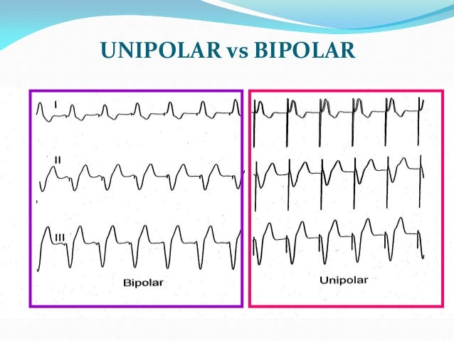 心臟植入性電子儀器(CIED )之歷史”CIED Overview “_20130907北區