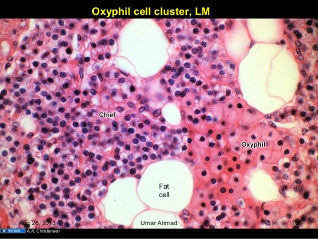 Parathyroid Histology Chief Cells