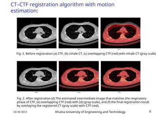 0909015registrationalgorithmwithrespiratorymotion.ppt