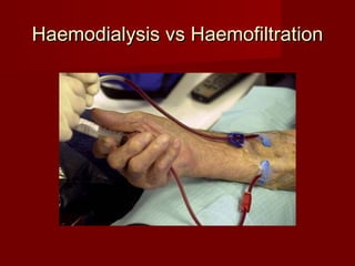 Michaela Cartner on Dialysis | PPT